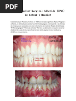 Clasificacion de Vertucci | PDF | Diente | Anatomia dental