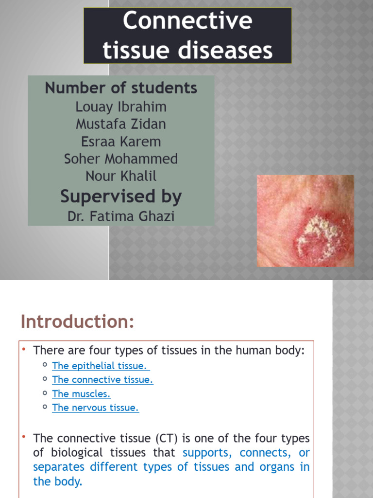 Connective Tissue Disorders PDF | PDF | Autoimmune Disease | Tooth Enamel