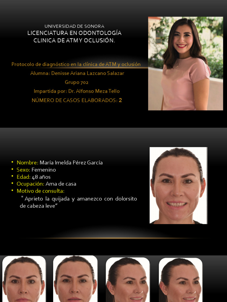 Lazcano Salazar Denisse Ariana | PDF | Dolor de cabeza | Migraña