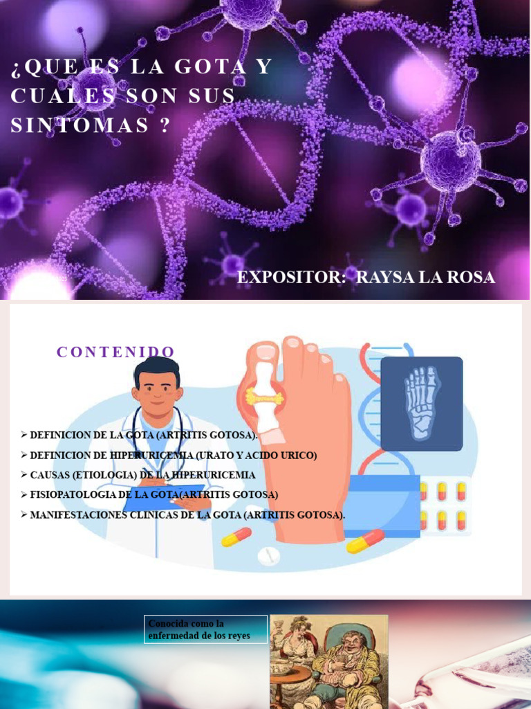 Enfermedad de La Gota | PDF | Gota | Medicina
