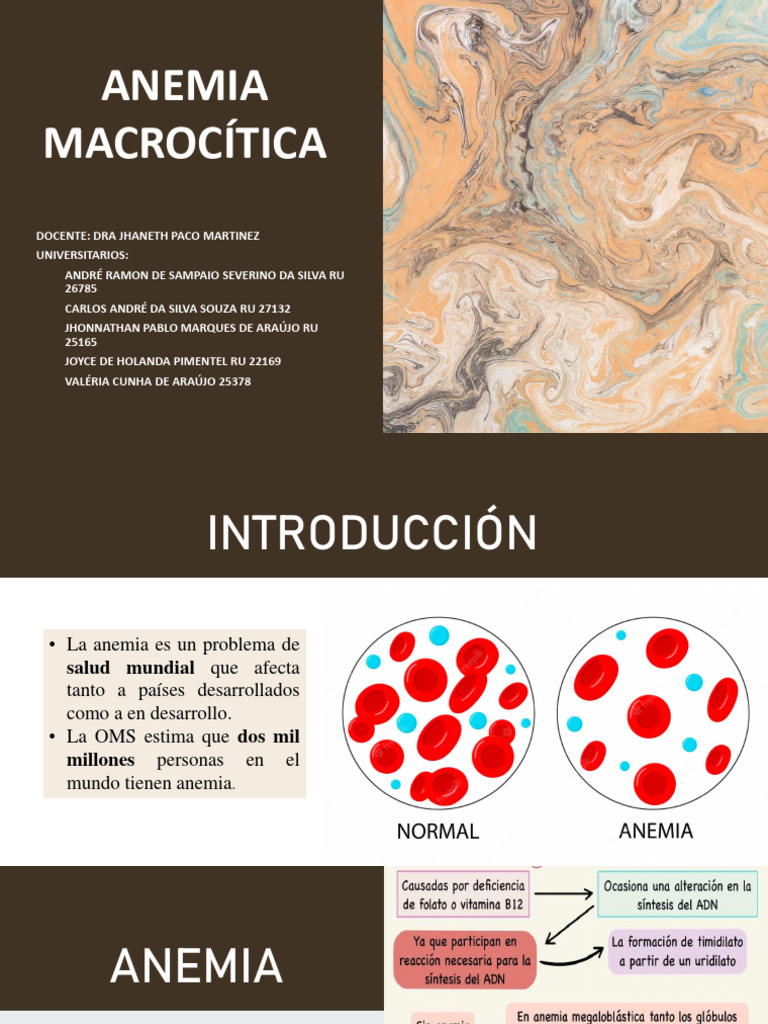 Anemia Macrocítica | PDF | Anemia | Especialidades Medicas