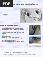 Palato-Labial Tooth Movement Z Spring: Uses | PDF | Dentistry ...
