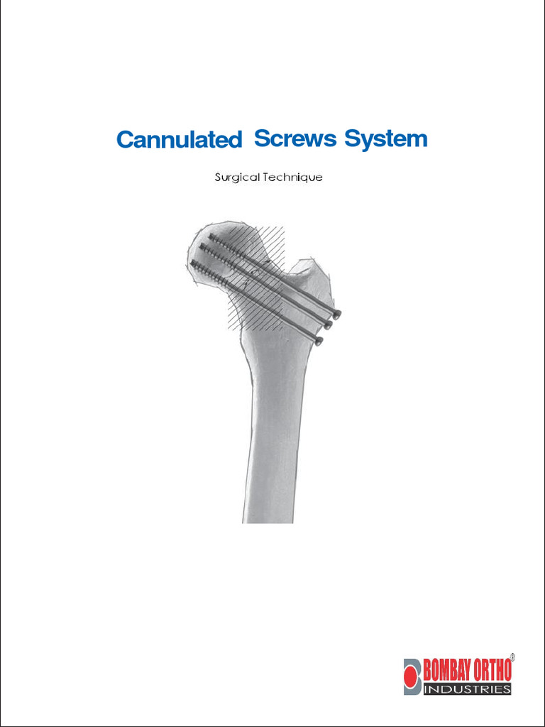 Cannulated Screw Surgical Technique | PDF