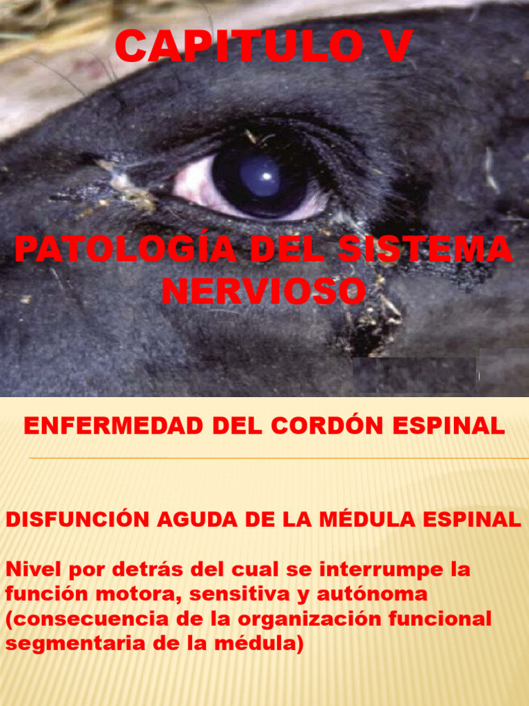 Patologias Sistema Nervioso. Capitulo V | PDF | Médula espinal | Meningitis