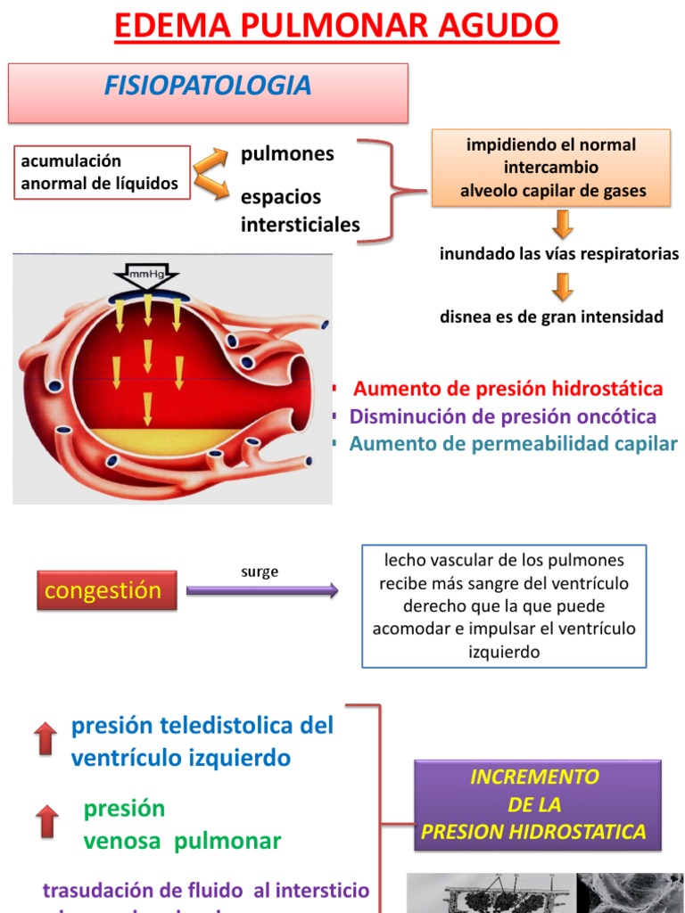 Fisiopatologia Edema Pulmonar Agudo | PDF | Edema | Pulmón