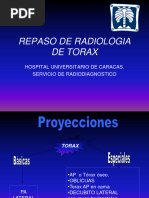 Radiografía de Tórax Normal - Patrón Intersticial | PDF | Pulmón | Tórax