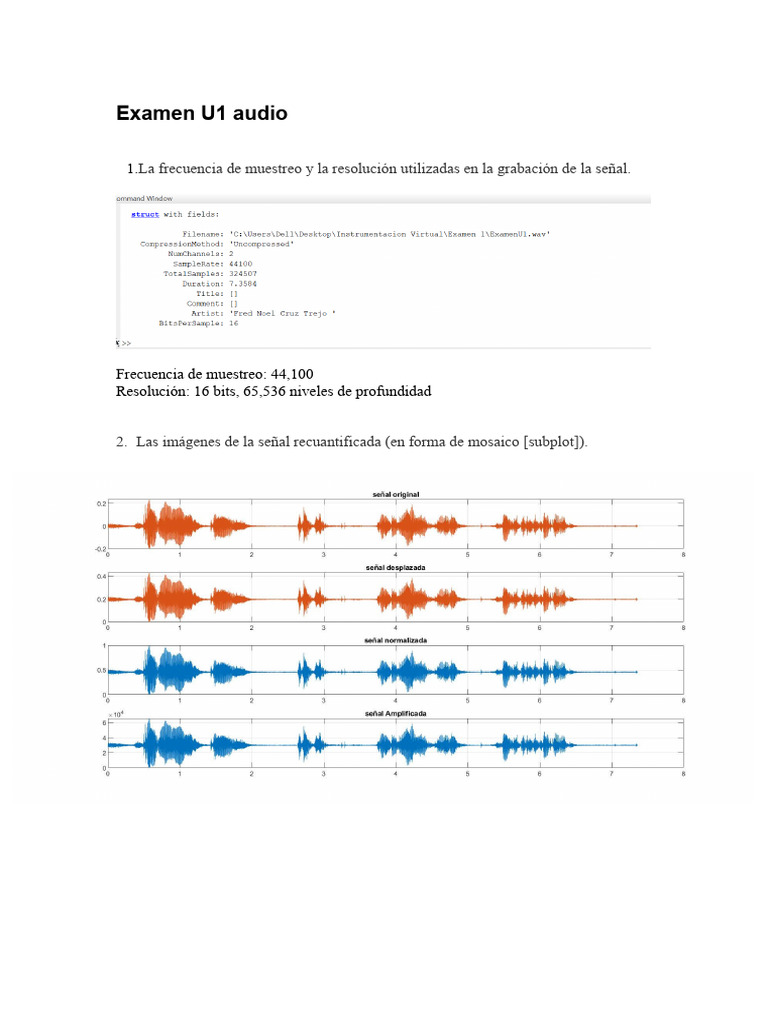 Examen U1 Audio | PDF | Métodos y materiales de enseñanza