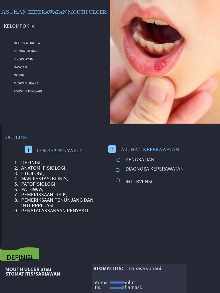 Asuhan-Keperawatan-Mouth-Ulcer | PDF