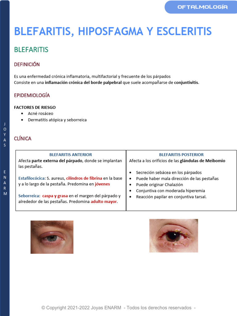 Blefaritis, Hiposfagma, Escleritis | PDF | Medicina CLINICA ...