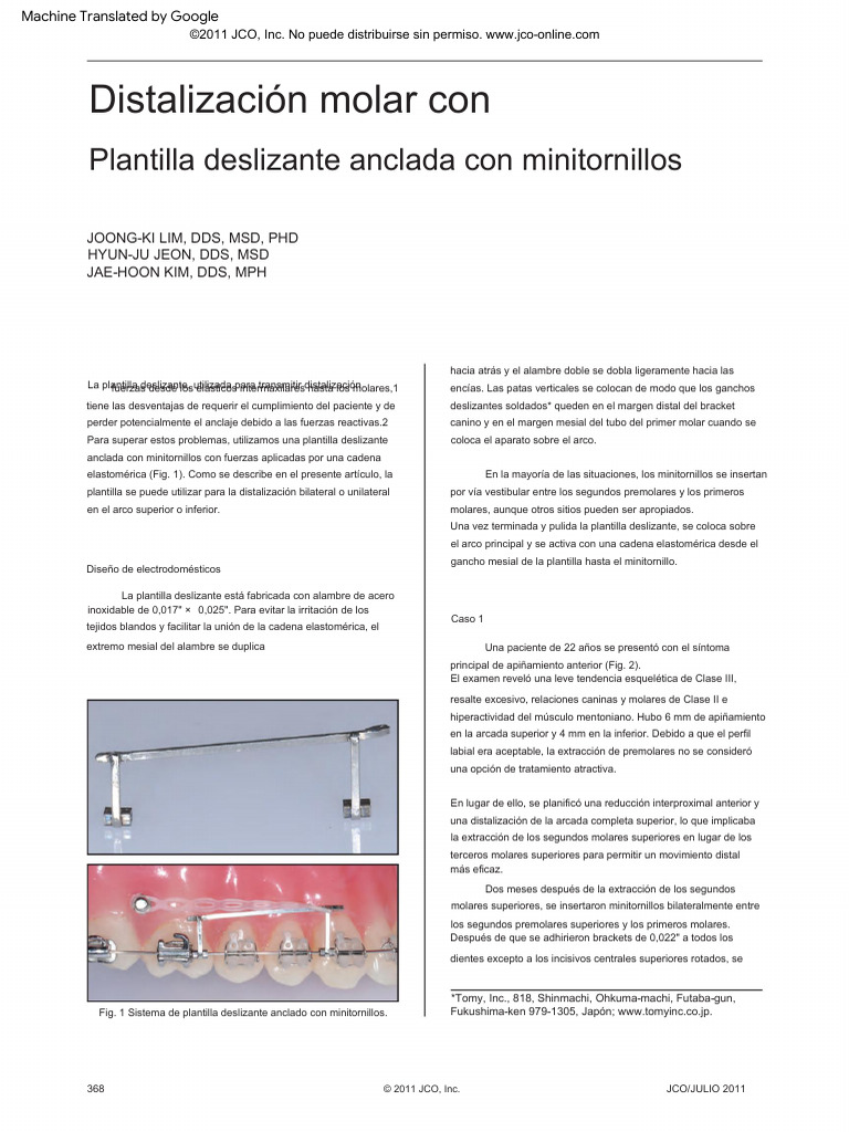 Molar Distalization With A Miniscrew Anchored Sliding Jig | PDF