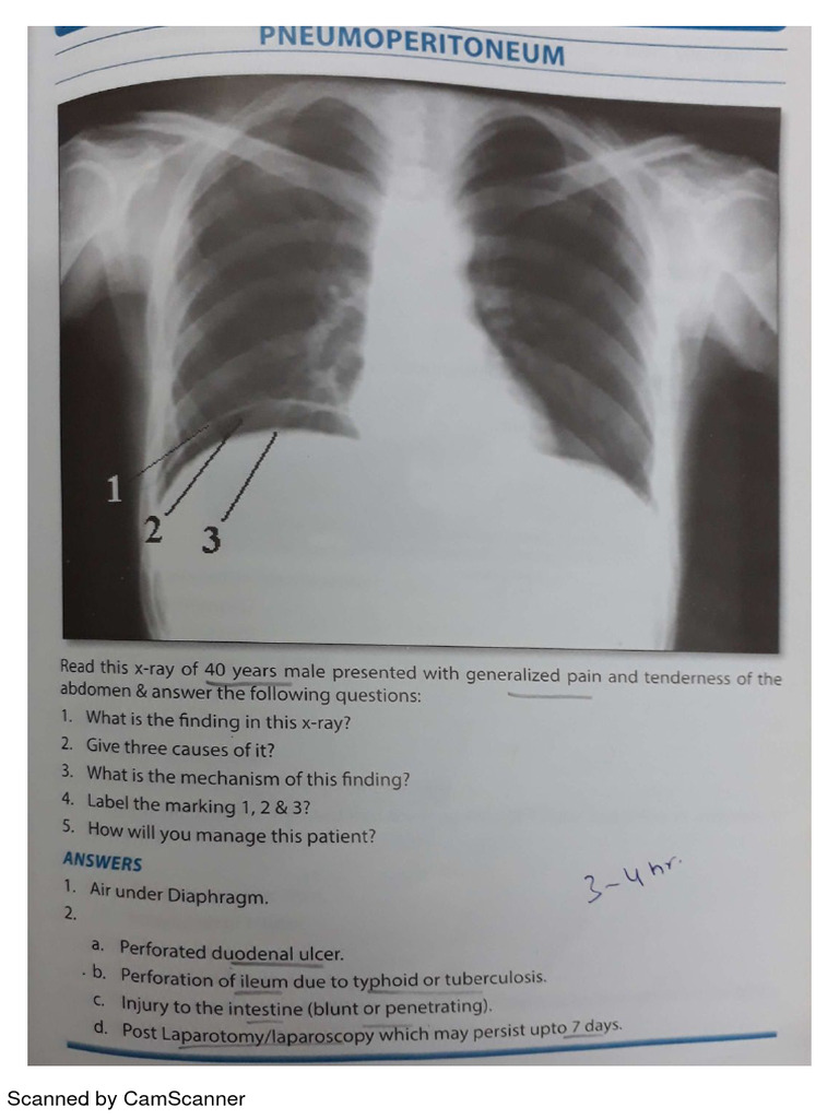 Dogar Ospe PDF | PDF