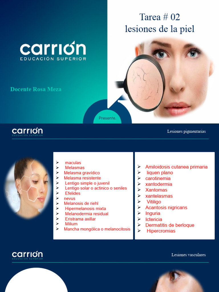 Tarea Lesiones de La Piel | PDF