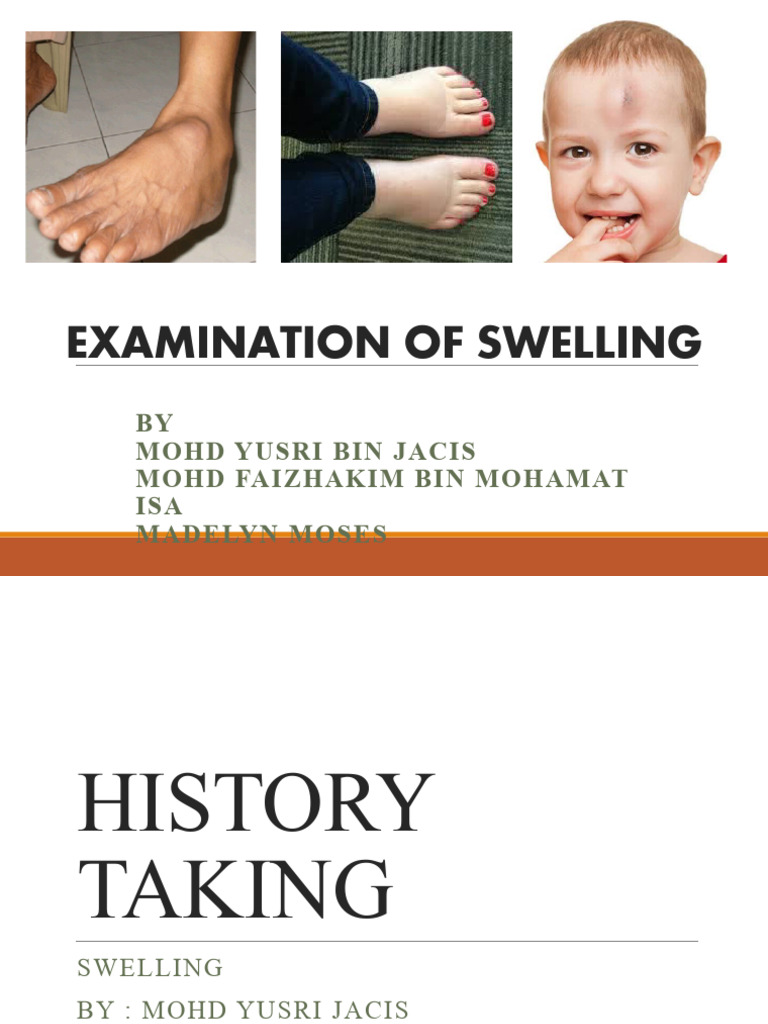 Examination of Swelling | PDF | Science & Mathematics