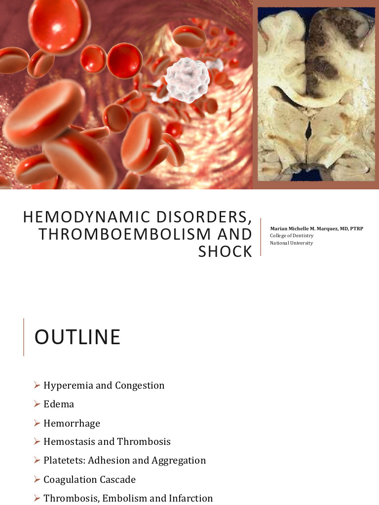 Lec4 Hemodynamic Disorders, Thromboembolism and Shock | PDF