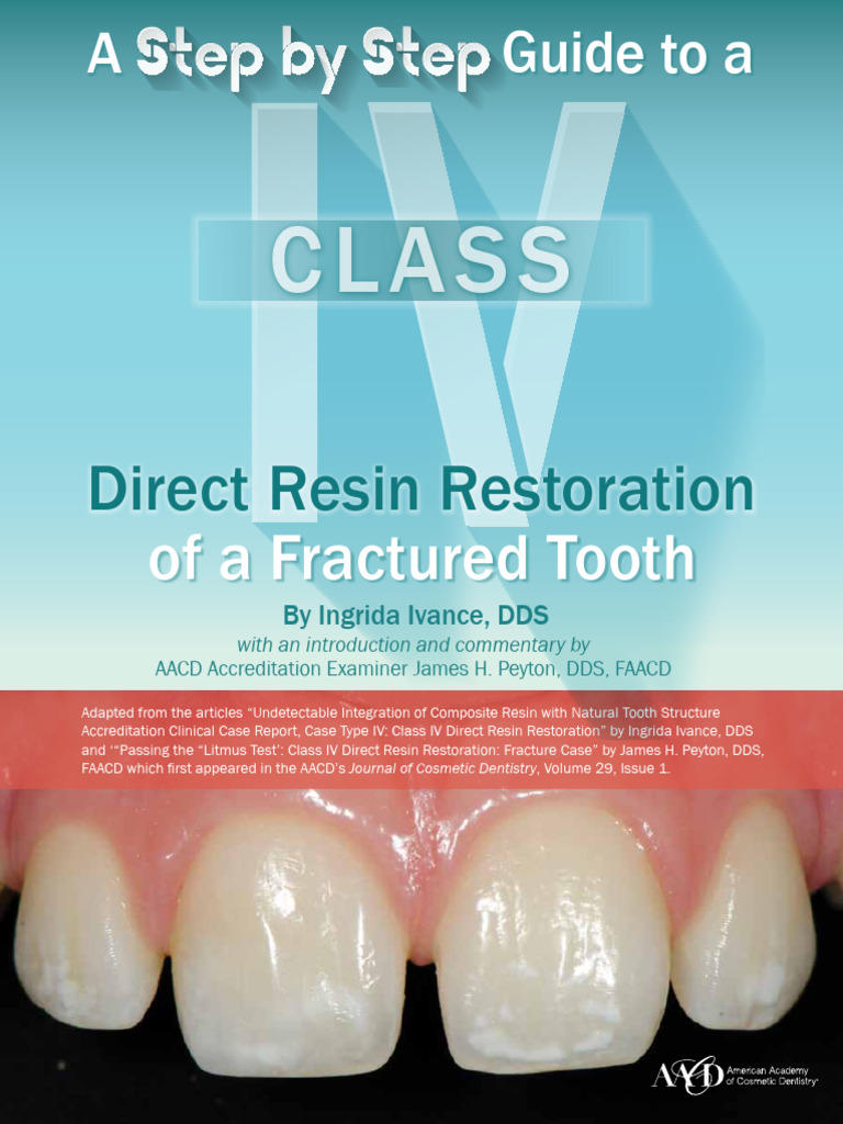 Step by Step Guide To A Class IV Direct Resin Restoration | PDF | Self ...