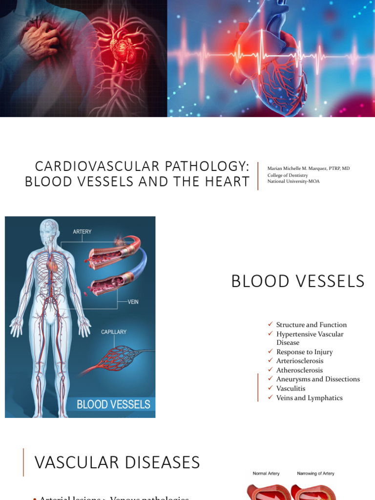 Lec10 CV Pathology | PDF | Heart | Myocardial Infarction