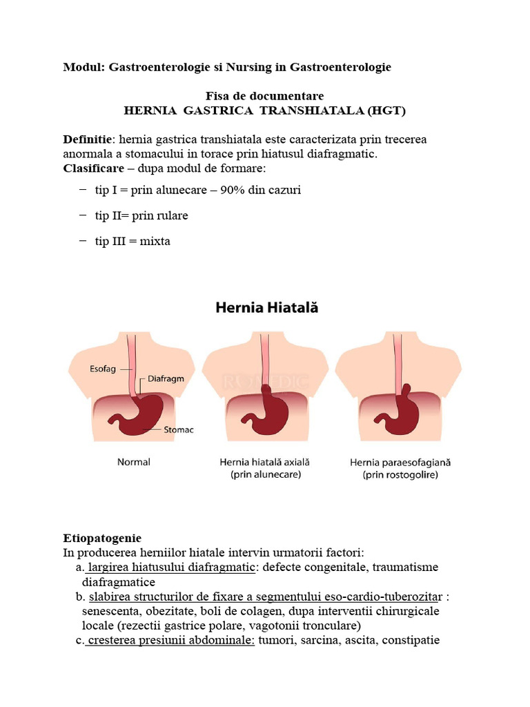 Hernia Hiatala | PDF