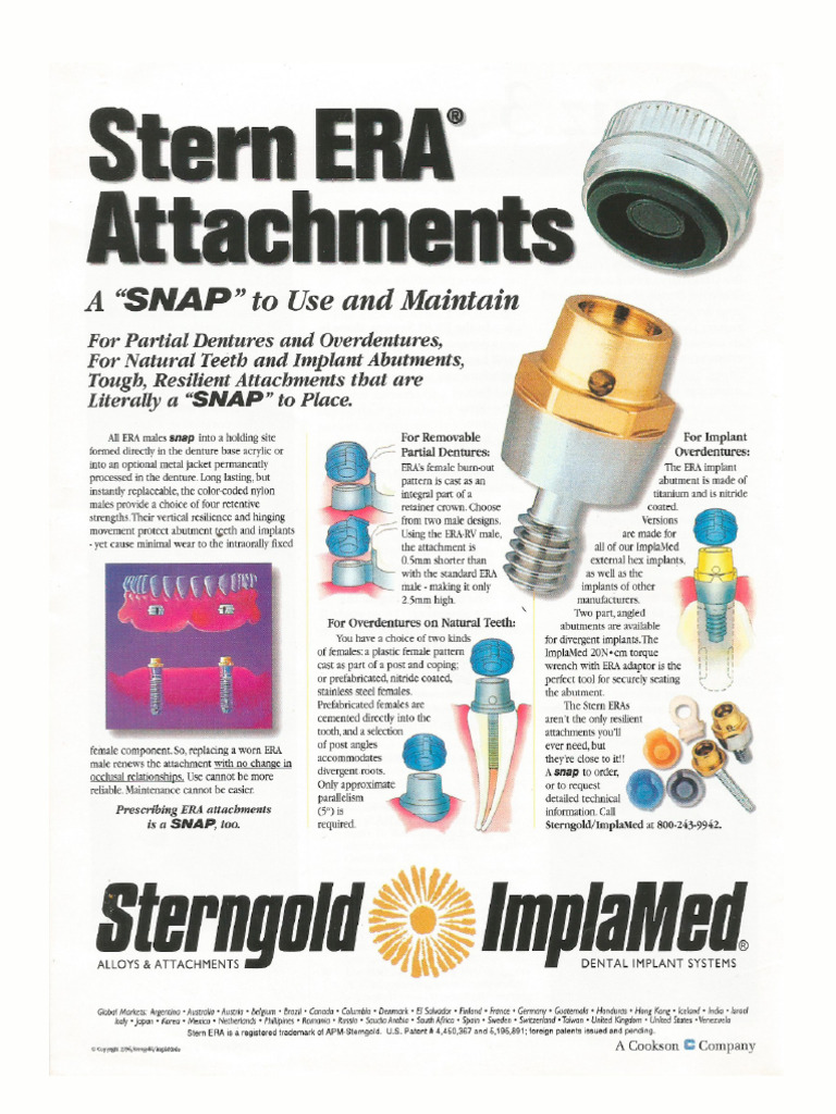 Sterngold The Era Implant Supported | PDF
