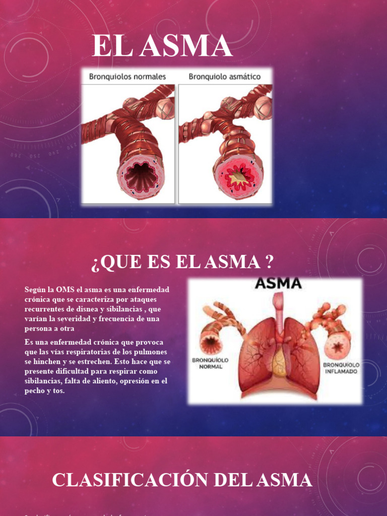 Clasificación y Tratamiento del Asma | PDF | Asma | Causas de la muerte