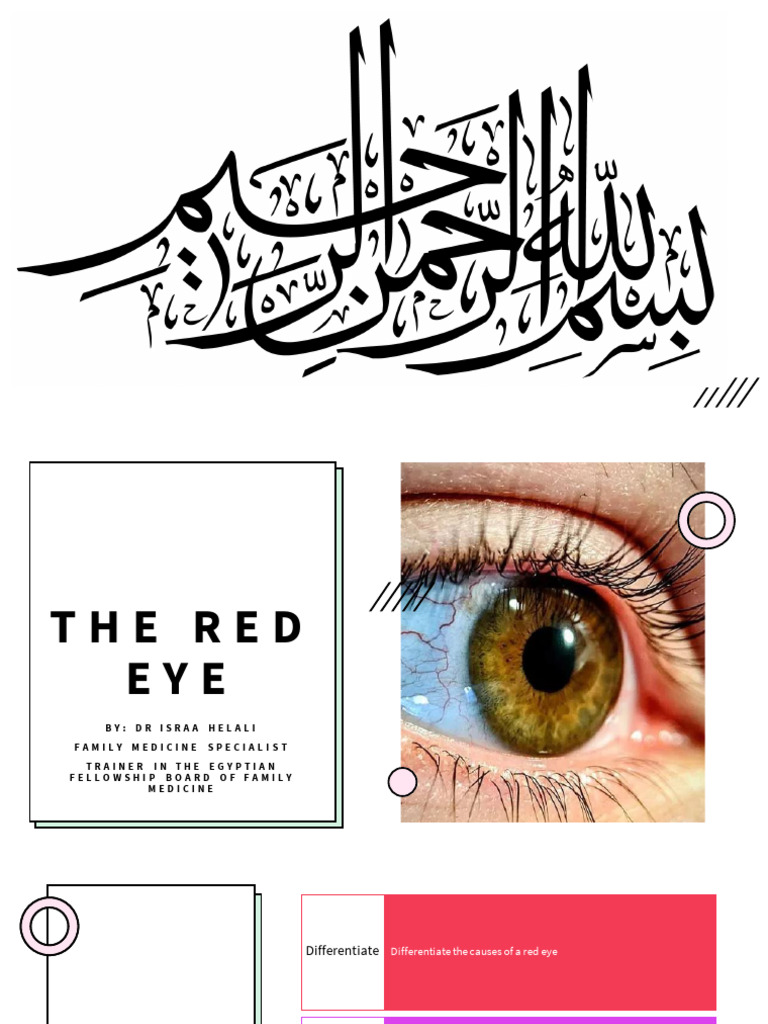 The Red Eye | Download Free PDF | Vision | Diseases And Disorders