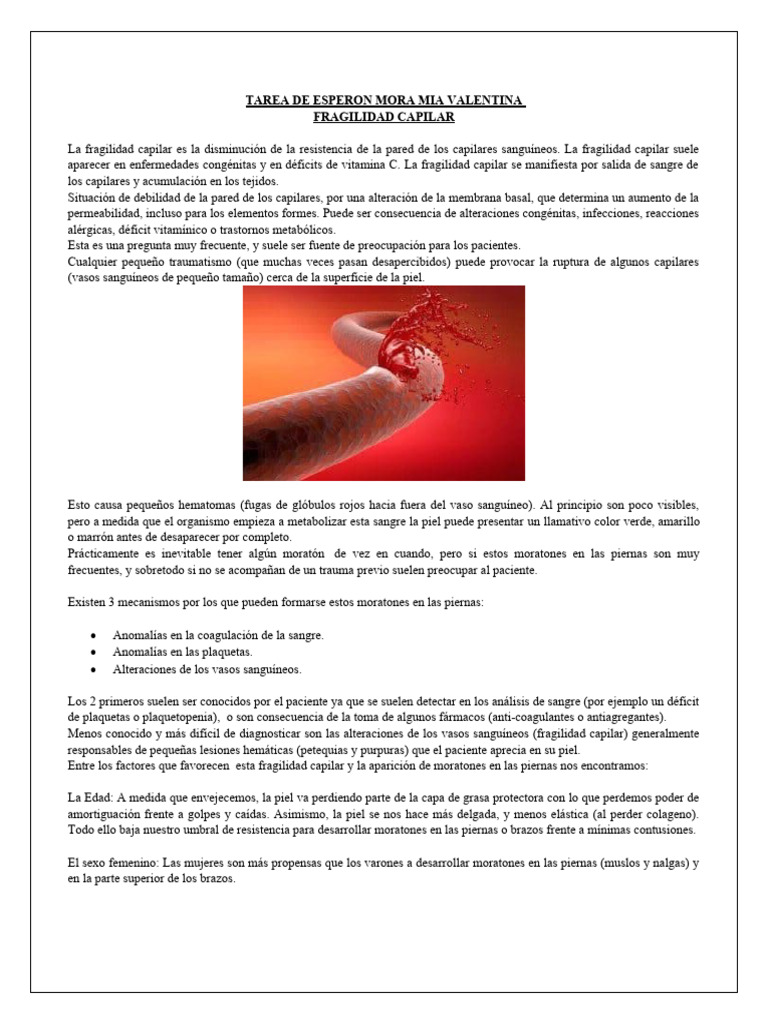 Fragilidad Capilar: Causas y Tratamiento | PDF | Aterosclerosis | Isquemia