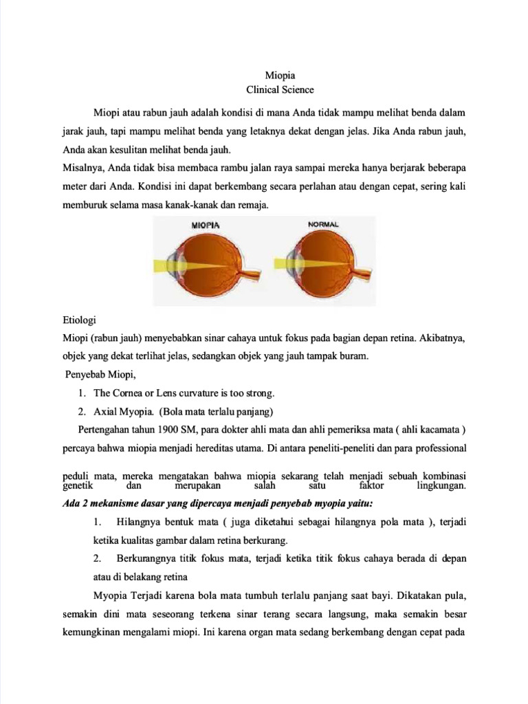 PDF Miopia Compress | PDF