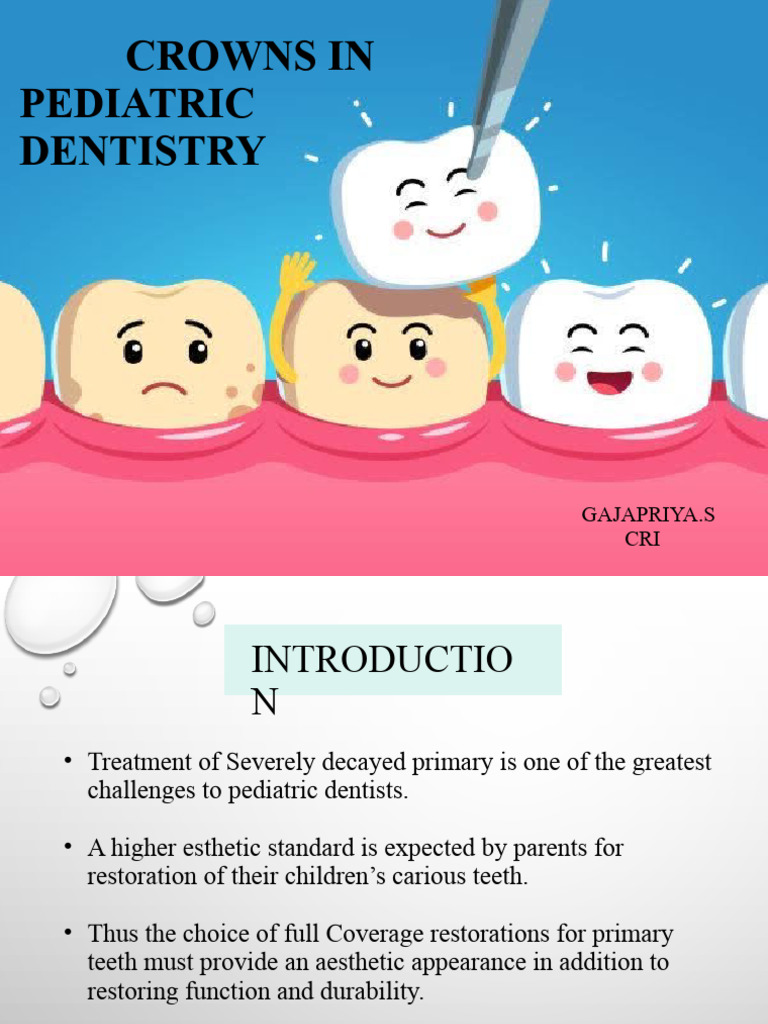 Crowns in Pediatric Dentistry | PDF | Alloy | Dental Composite