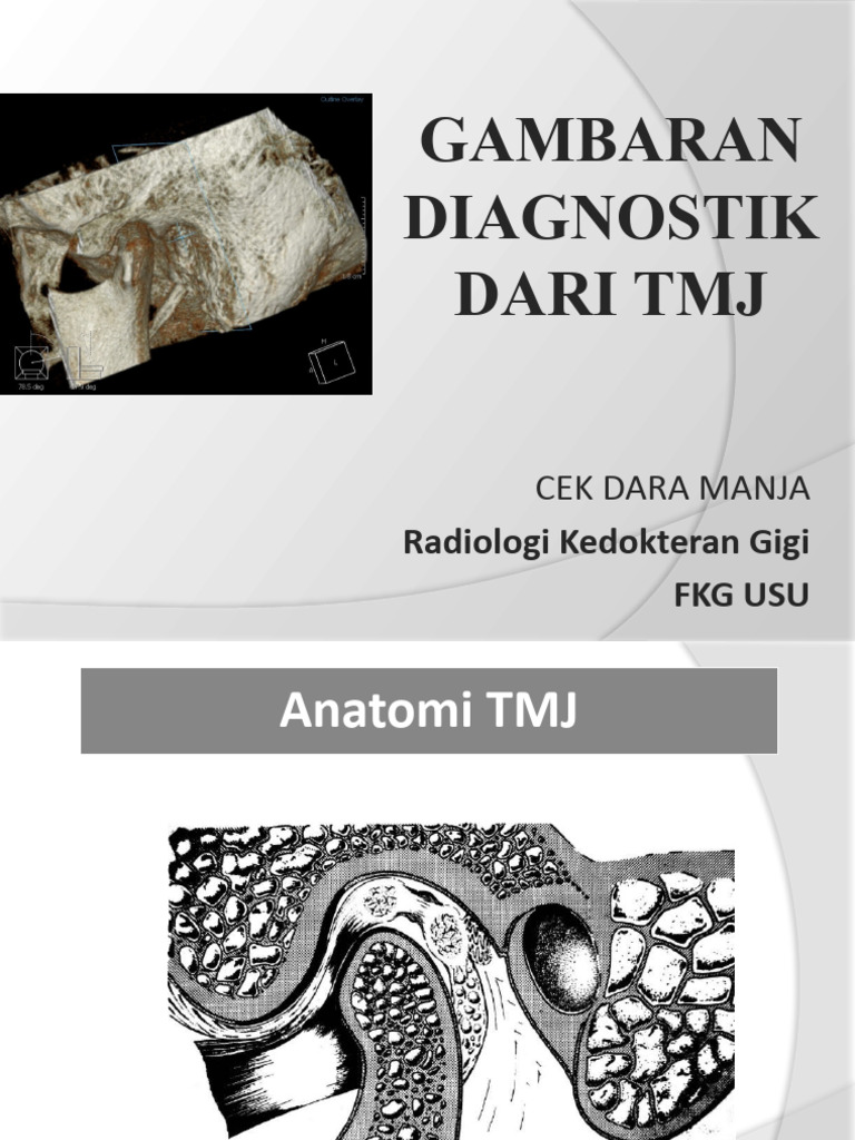 RD 5.8 Gambaran Radiografi Anatomi Normal Dan Patologis Dan Teknik ...