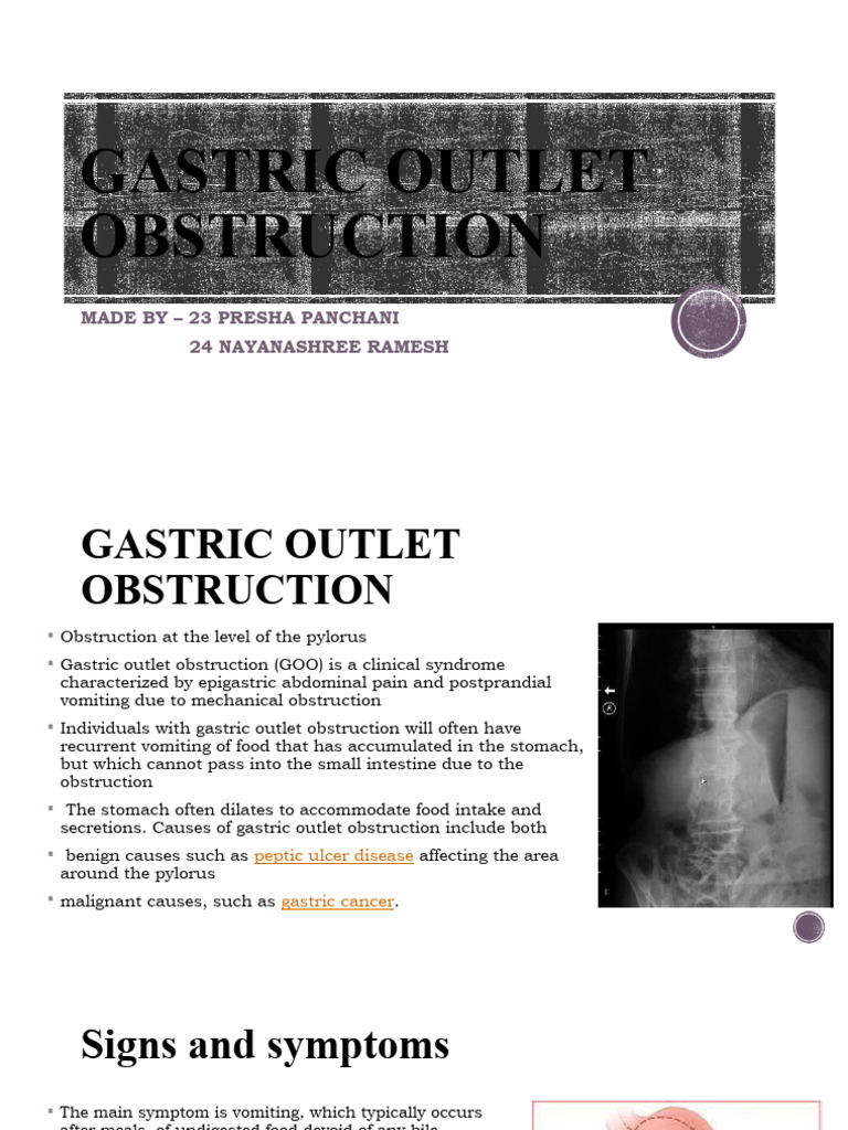 Gastric Outlet Obstruction | PDF