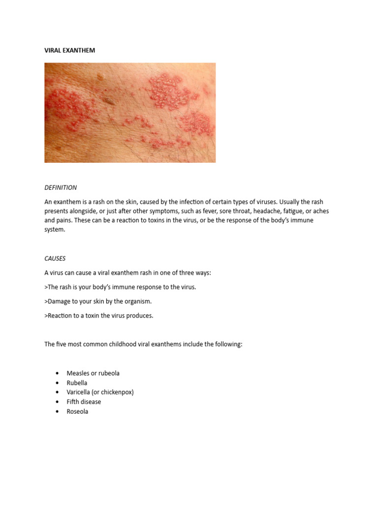 Viral Exanthem Review Paper | PDF | Wellness | Science & Mathematics