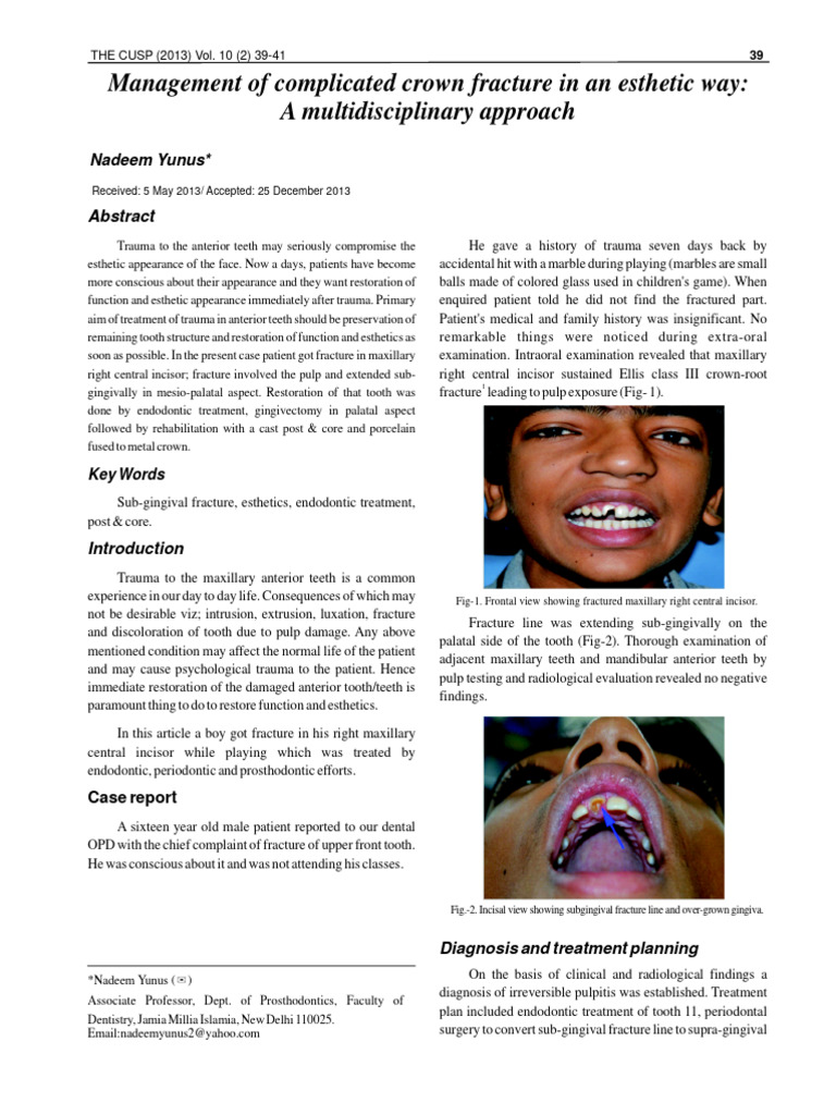 Management of Complicated Crown Fracture in An Esthetic Way. | PDF ...
