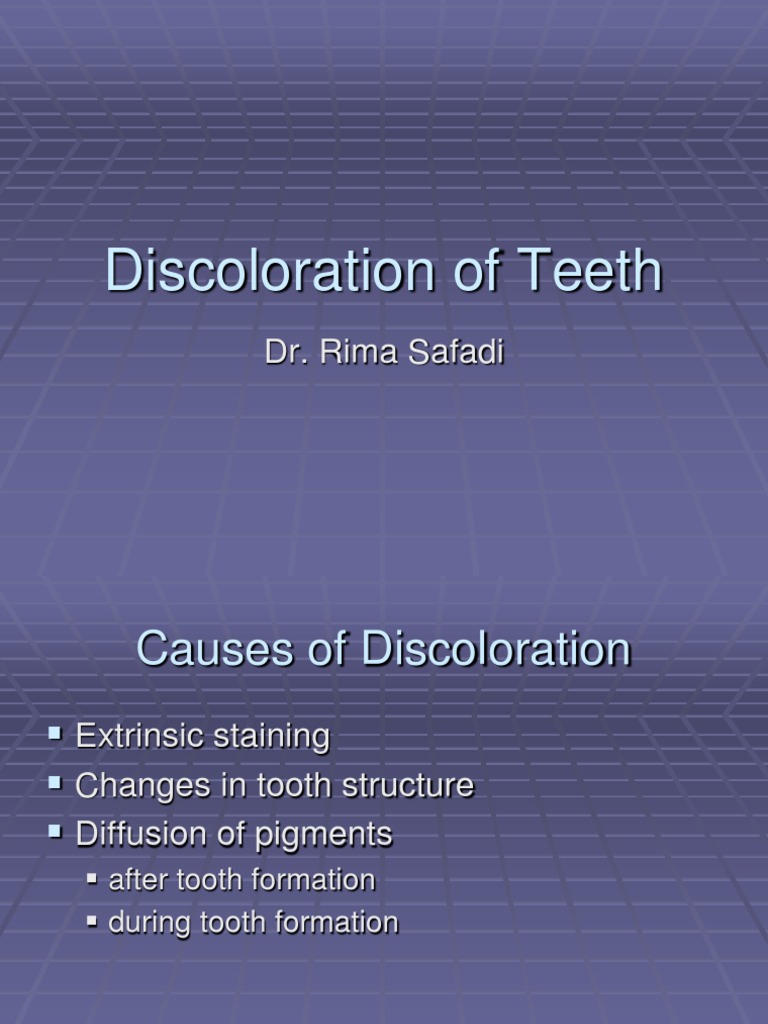 Management of Tooth Discoloration | PDF | Human Tooth | Tooth Enamel
