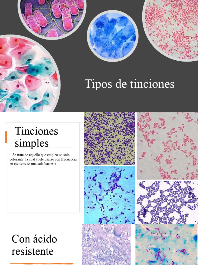 Tipos de Tinción VISU | PDF