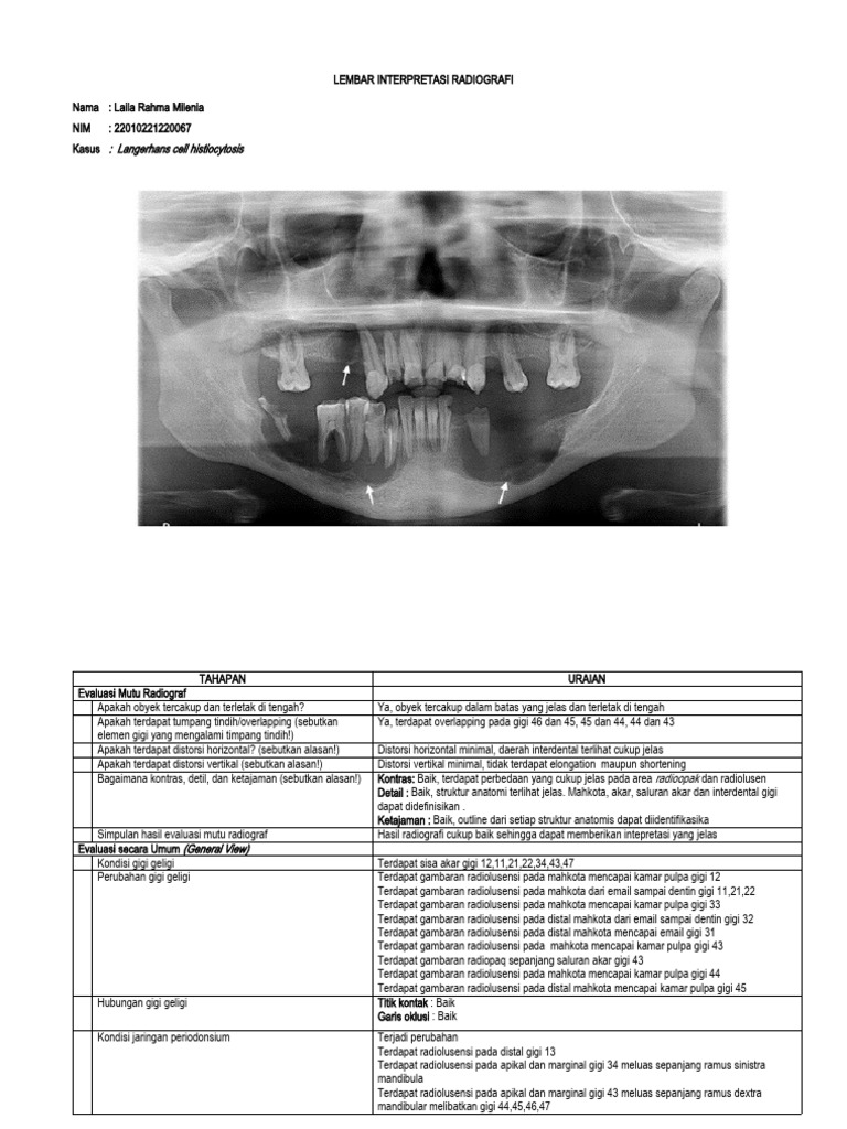 Lembar Interpretasi Radiografi TM 2 | PDF | Kajian Bahasa Asing