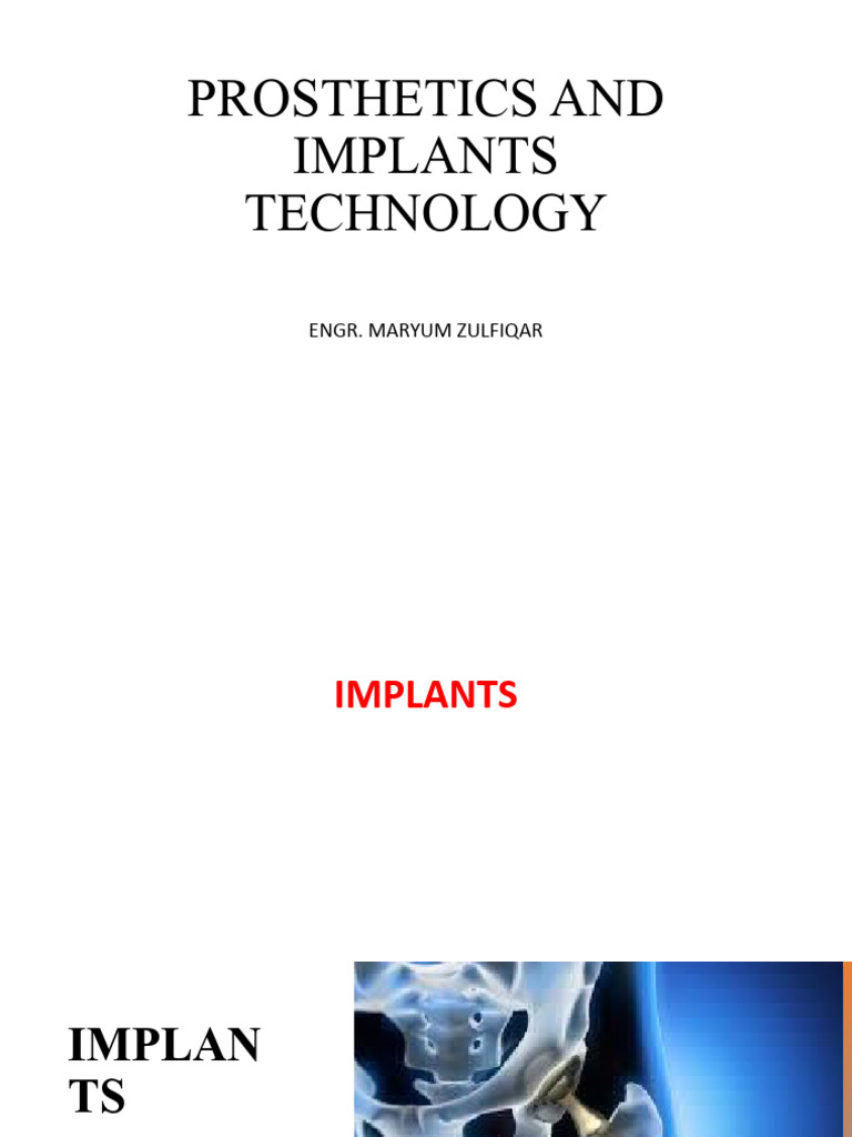 lec 9 | PDF | Fracture | Stainless Steel