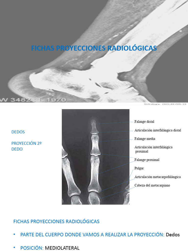 Fichas Proyecciones Radiológicas | PDF