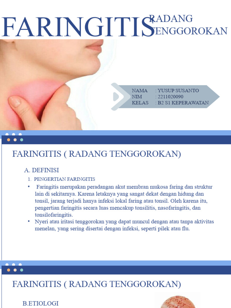 Mencegah Penyakit Faringitis | PDF