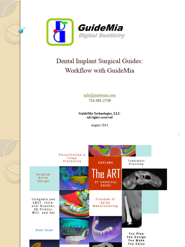 Dental Implant Guide Workflow Steps | PDF | Technology & Engineering