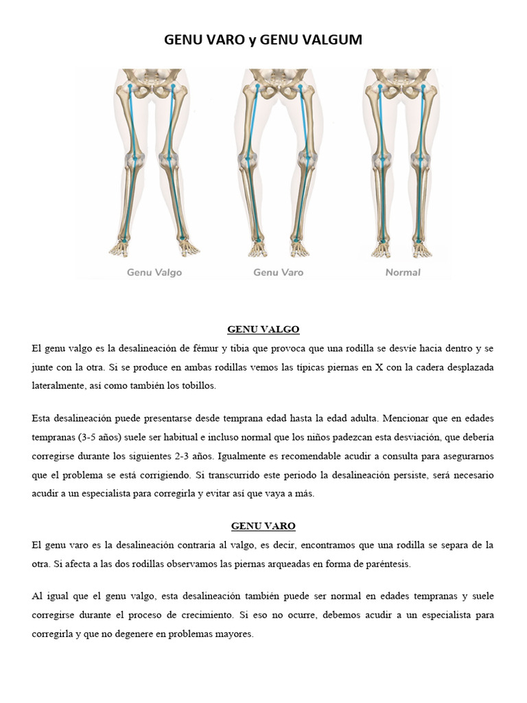 Genu Varo y Genu Valgum | PDF | Rodilla | Sistema musculoesquelético