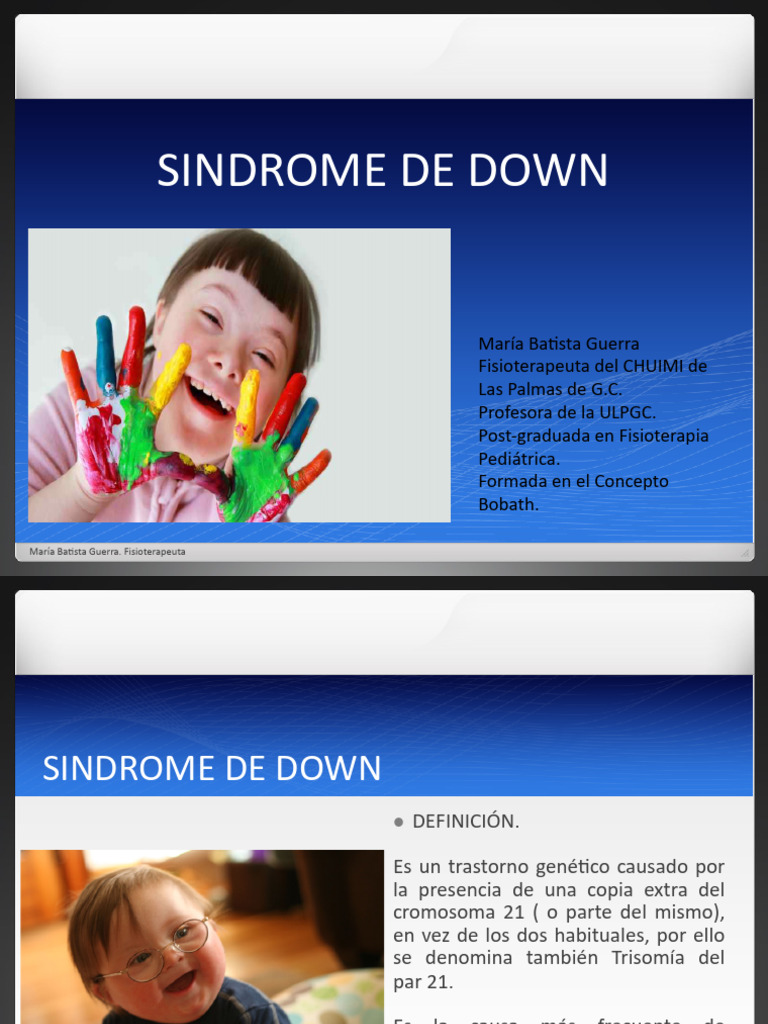 Sindrome de Down | PDF | Síndrome de Down | Enfermedades y trastornos humanos
