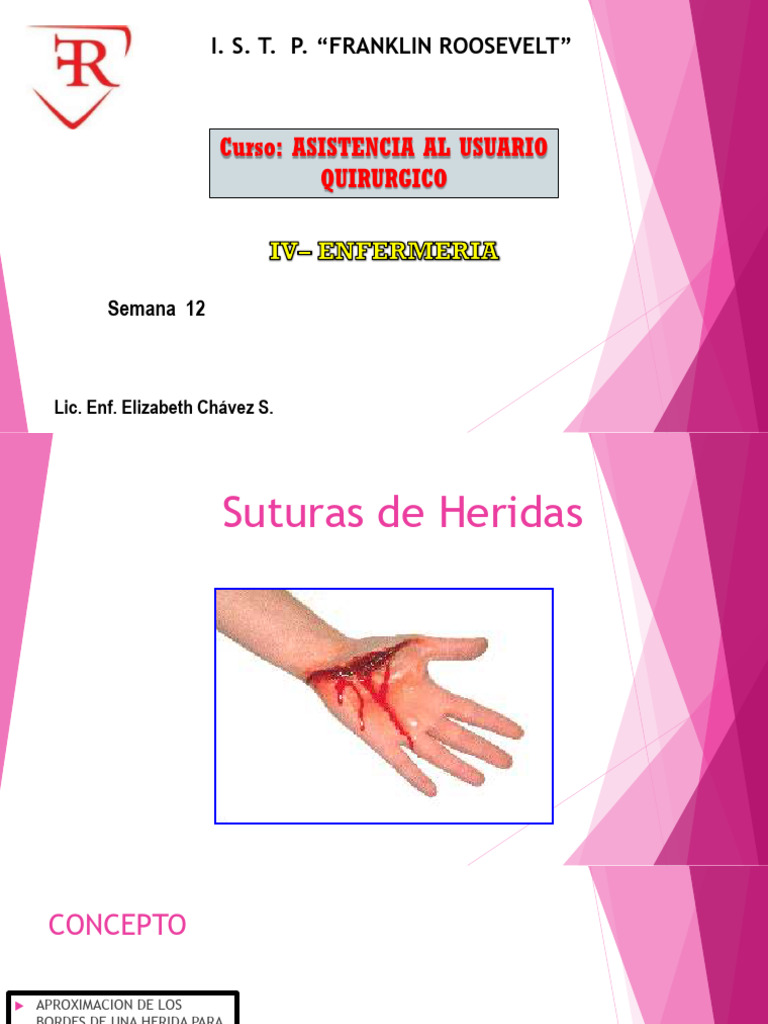 12 - Suturas - 231020 - 200126 | PDF | Sutura Quirúrgica | Herida