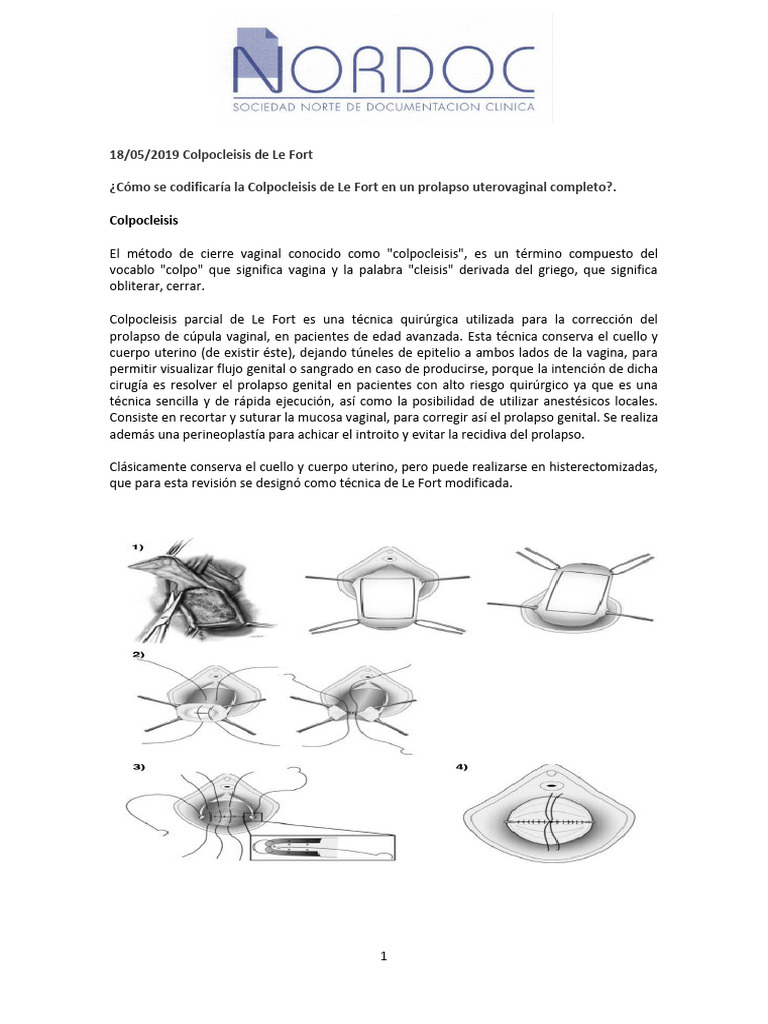 Colpocleisis Le Fort | PDF | Vagina | Medicina