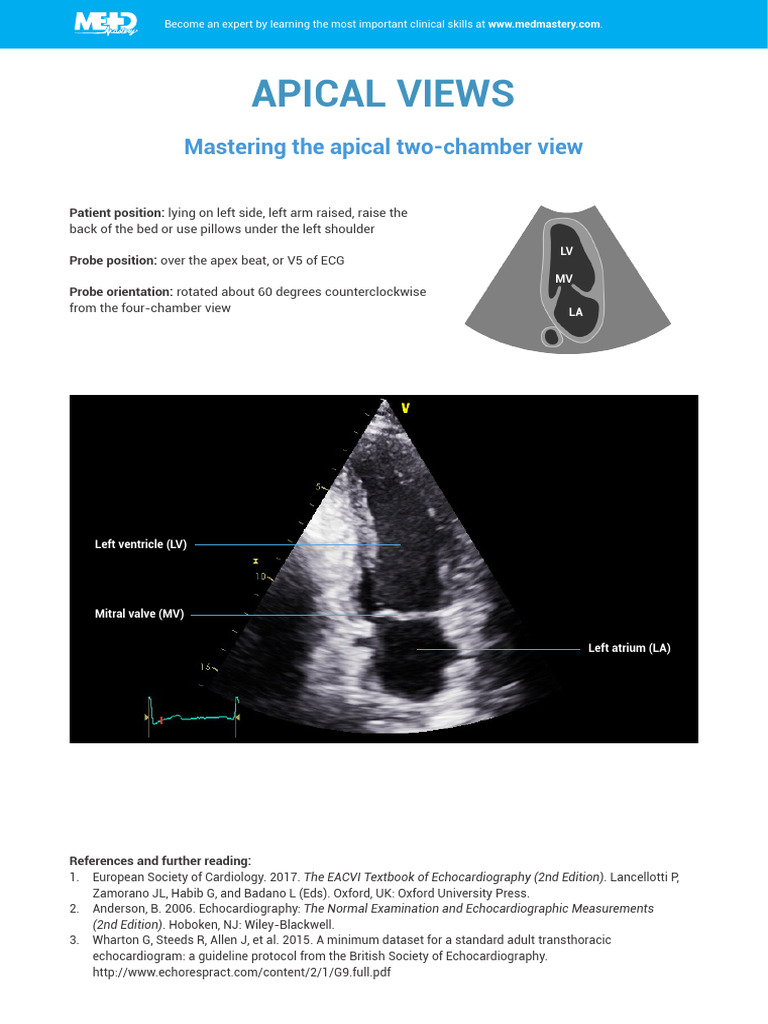 Mastering The Apical Two-Chamber View - ATF | PDF