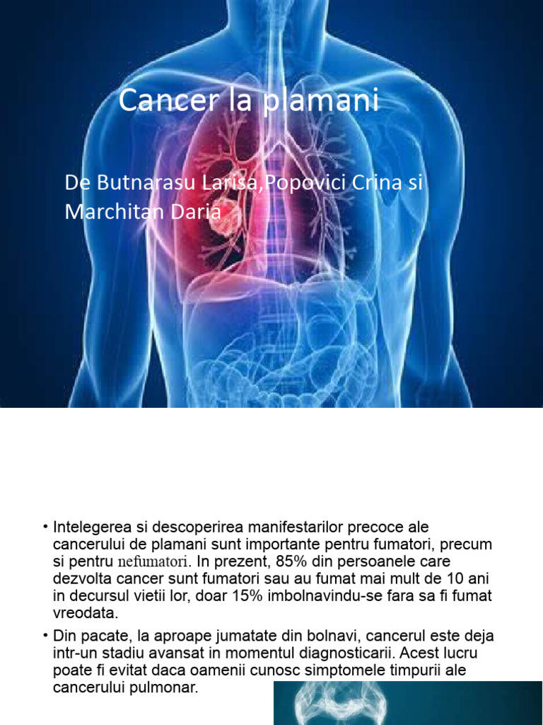 Cancer La Plamani | PDF