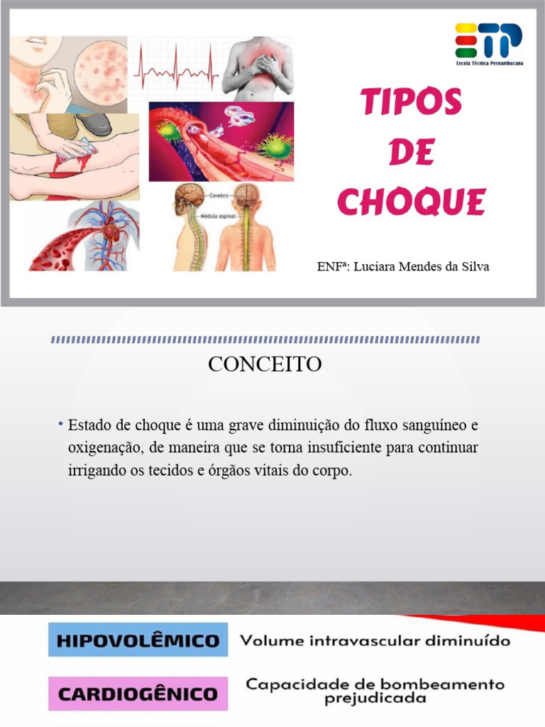 Aula 17 Tipos de Choque | PDF | Choque (circulatório) | Sepse