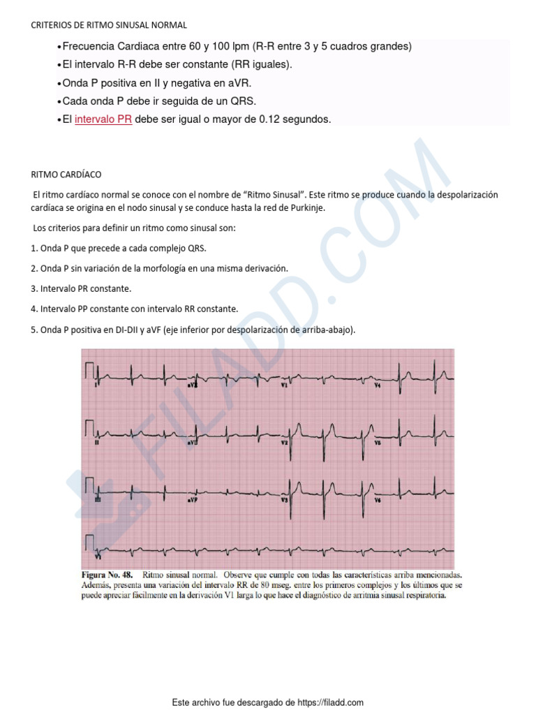 Criterios de Ritmo Sinusal Normal | PDF