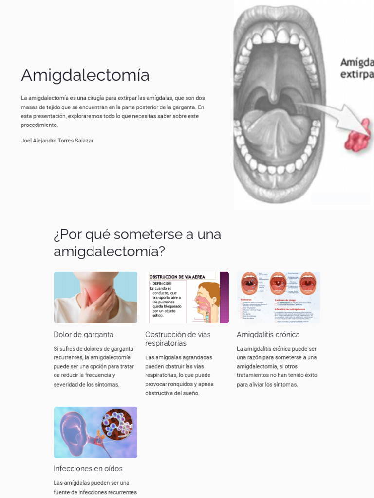 Guía Completa sobre Amigdalectomía | PDF | Ciencia y matemáticas