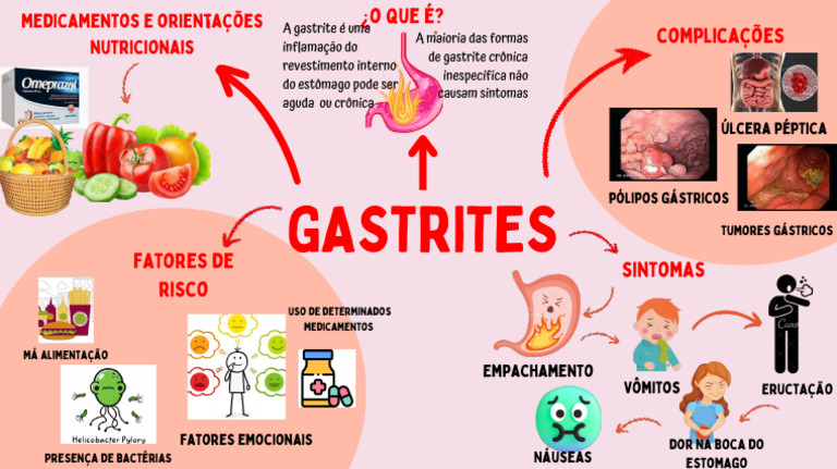 Mapa Mental Gastrites | PDF
