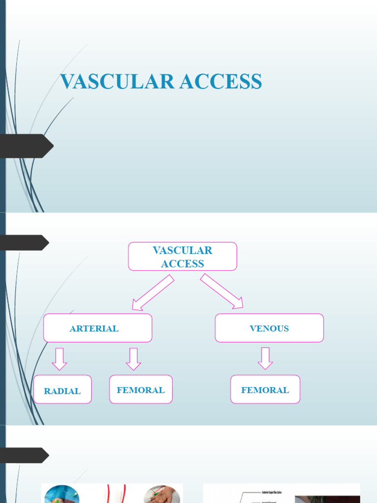 Vascular Access in Cardiac Catheterization | PDF