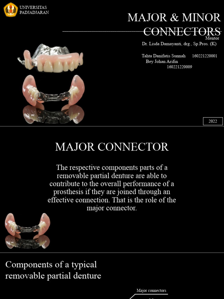 Major Minor Connectors Prost 22 | PDF